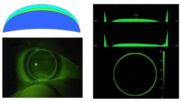 Central Zone - Back Optic Zone Radius - InnoCon