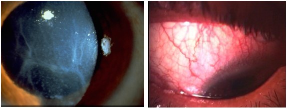 Toxic or Chemically Induced Staining - InnoCon
